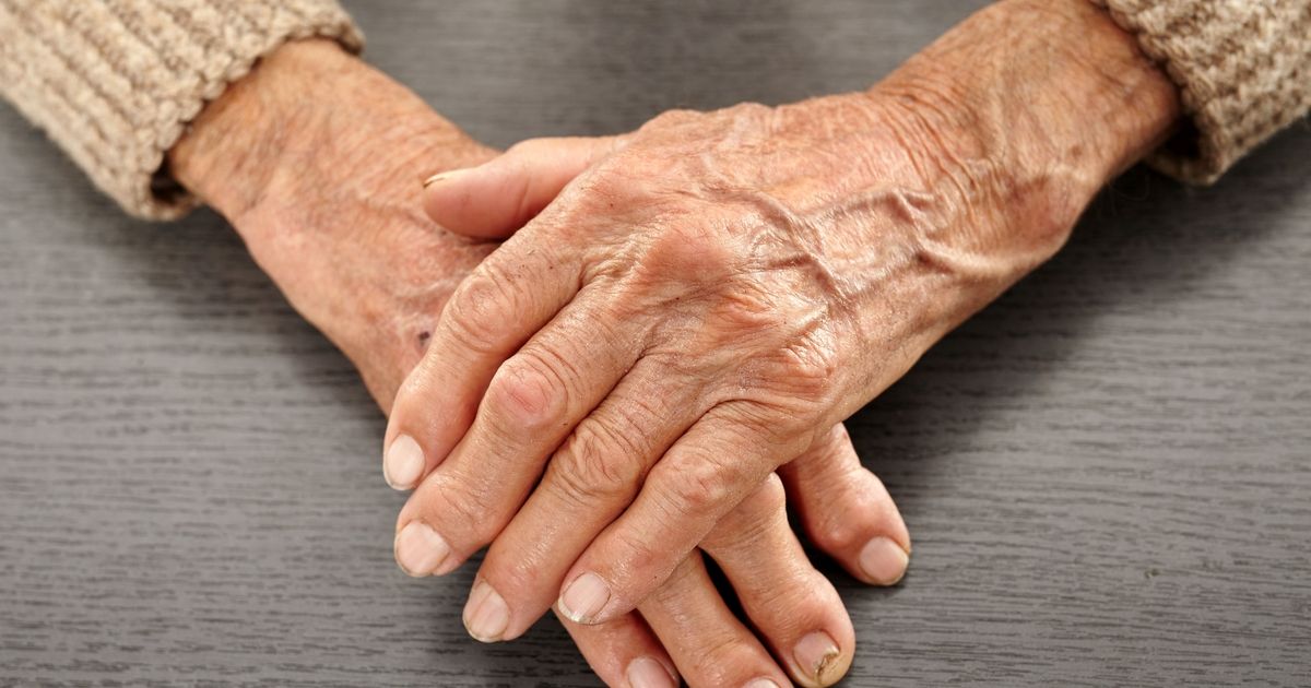 Vectra DA Rheumatoid Arthritis Dx Studies Detail New Test Model ...