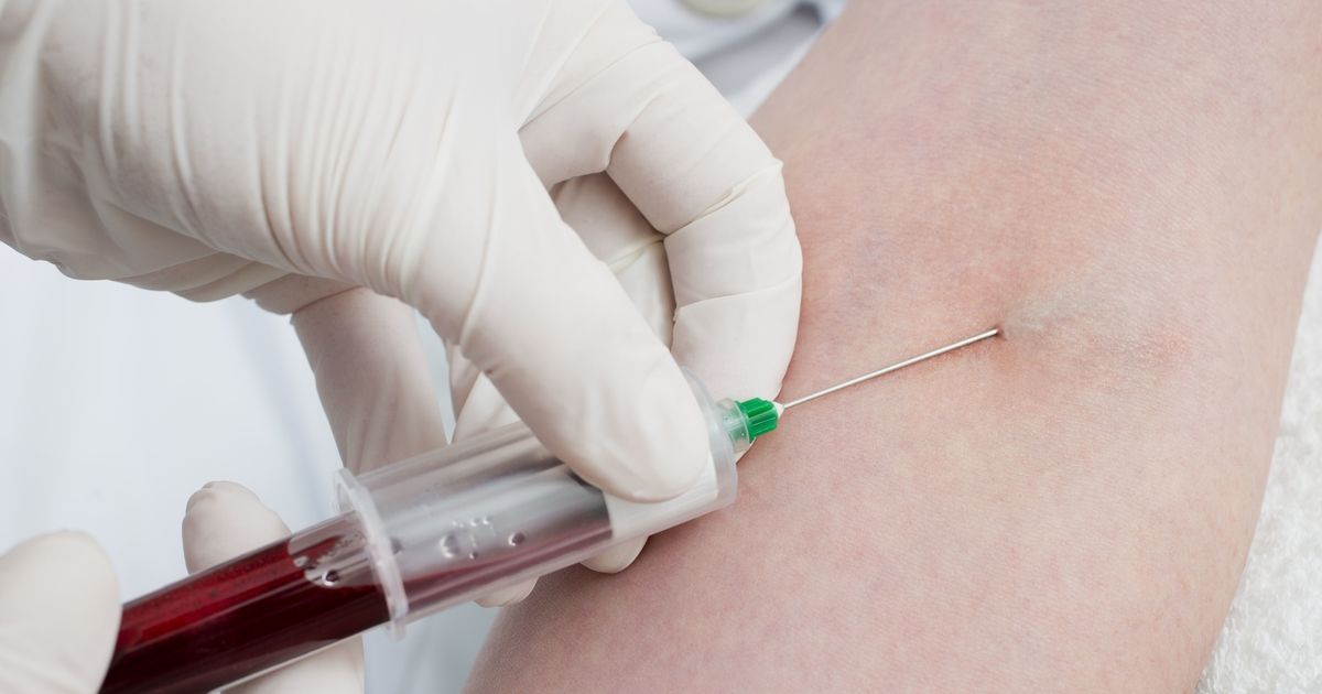 UK Researchers Developing Blood-Based TB DNA Test, Eyeing Broader ...