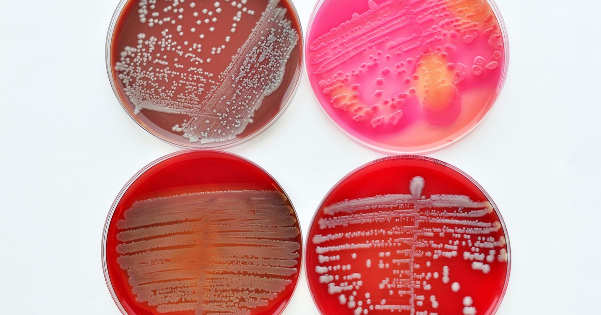 Nanomix Developing POC Test That May ID Sepsis in 10 Minutes | 360Dx Nanomix Developing POC Test That May ID Sepsis in 10 Minutes | 360Dx