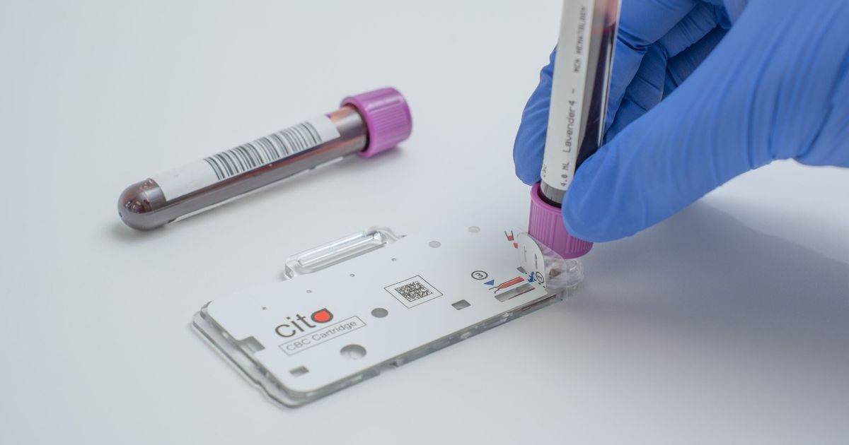 With FDA Clearance for POC Complete Blood Count Test, CytoChip Prepares ...