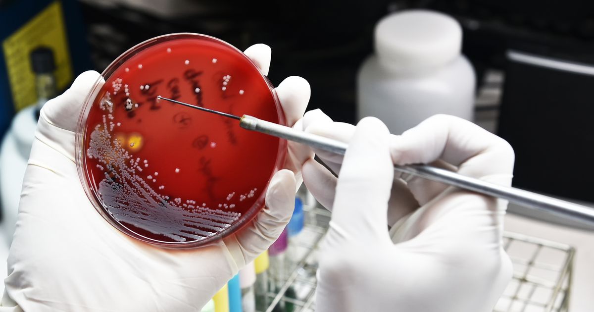 New Sepsis Testing Tools Emerging While Adoption Drags Amid Clinical ...