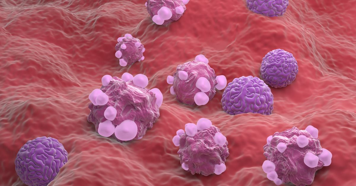 Johns Hopkins Researchers Use Machine Learning for Early Detection of ...
